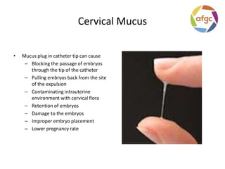 Embryo Transfer- Tips and Tricks to improve success | PPTX | Pregnancy ...