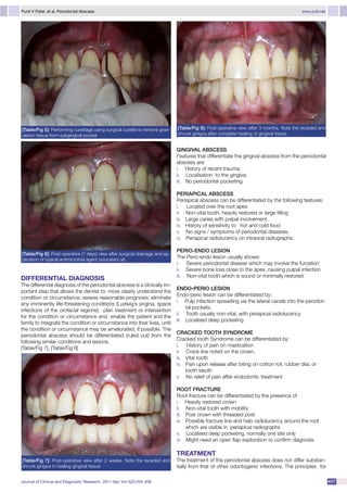 Et2 articulo 2 periodontal abscess 20190818214259 | PDF