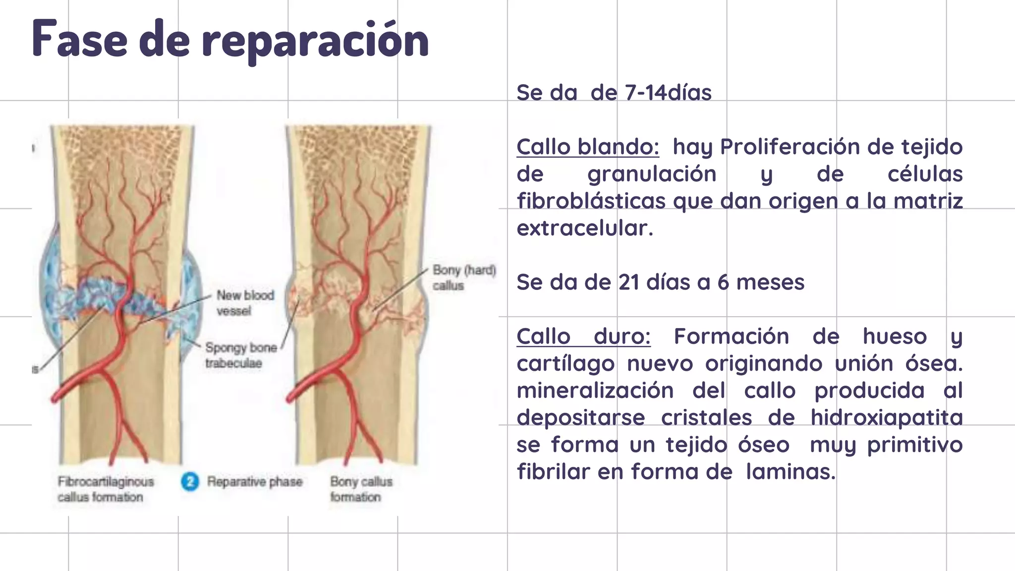 etapas de la consolidación osea | PPTX | Death, Injury, or Military ...