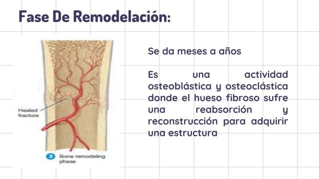 etapas de la consolidación osea | PPTX | Death, Injury, or Military ...