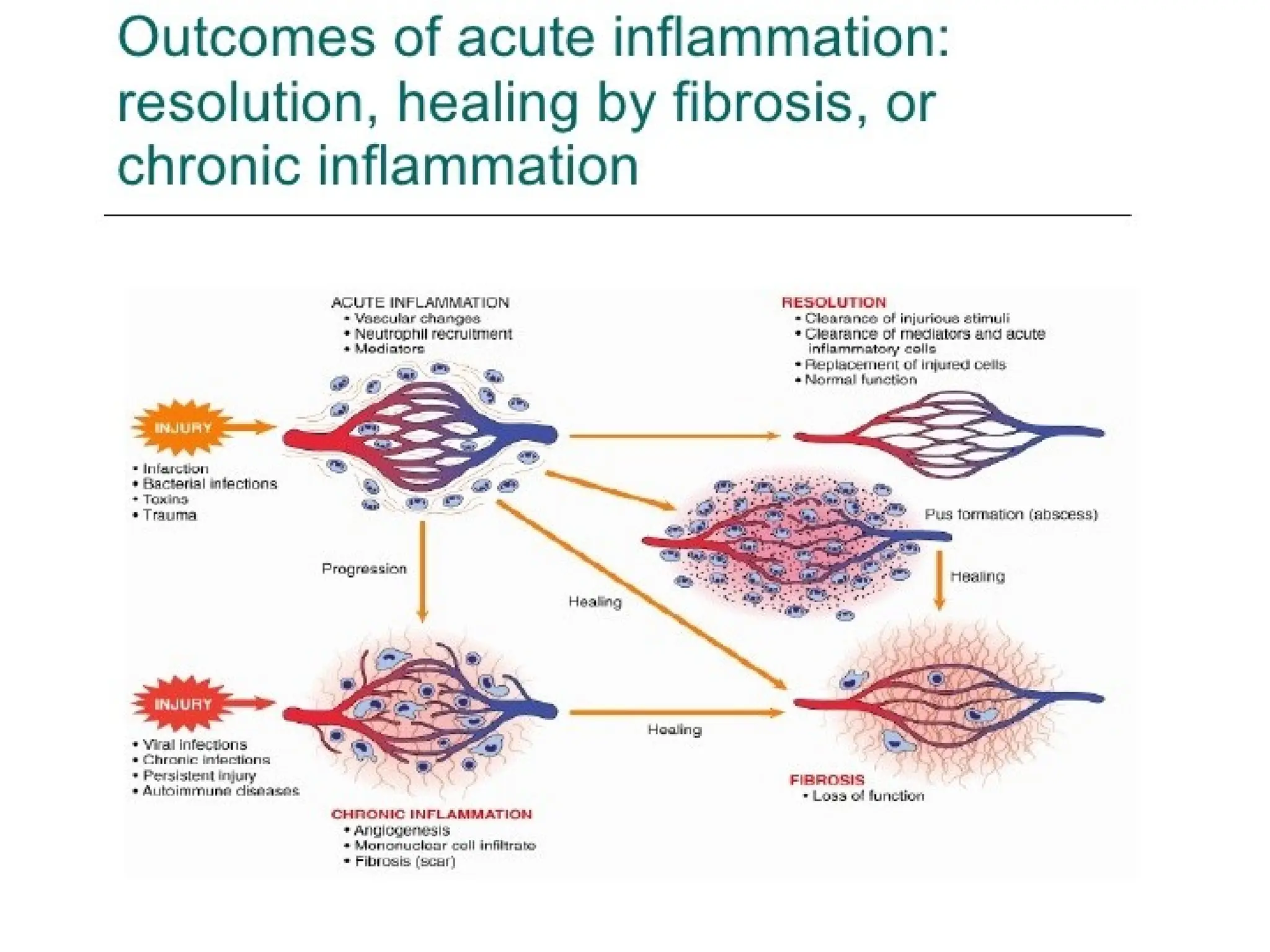 Etapas del proceso inflamatorio etapas.ppt