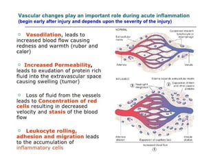 Etapas del proceso inflamatorio etapas.ppt