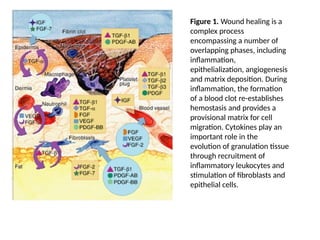 Etapas del proceso inflamatorio etapas.ppt
