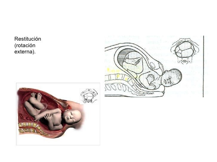 Etapas del trabajo de parto