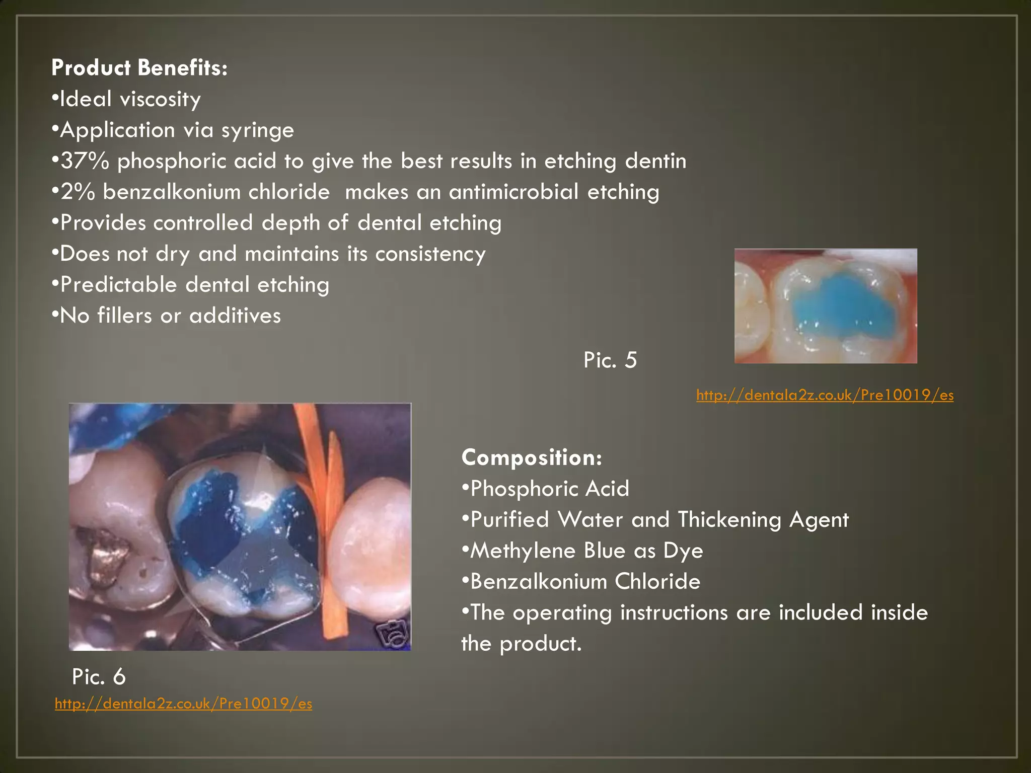 Etchant in dentistry | PDF