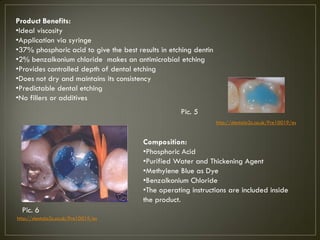 Etchant in dentistry | PDF
