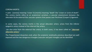 EXTENDED TOTALLY EXTRA-PERITONEAL REPAIR {eTEP} | PPTX