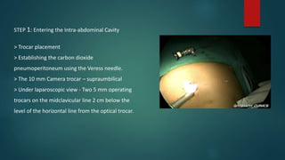 EXTENDED TOTALLY EXTRA-PERITONEAL REPAIR {eTEP} | PPTX