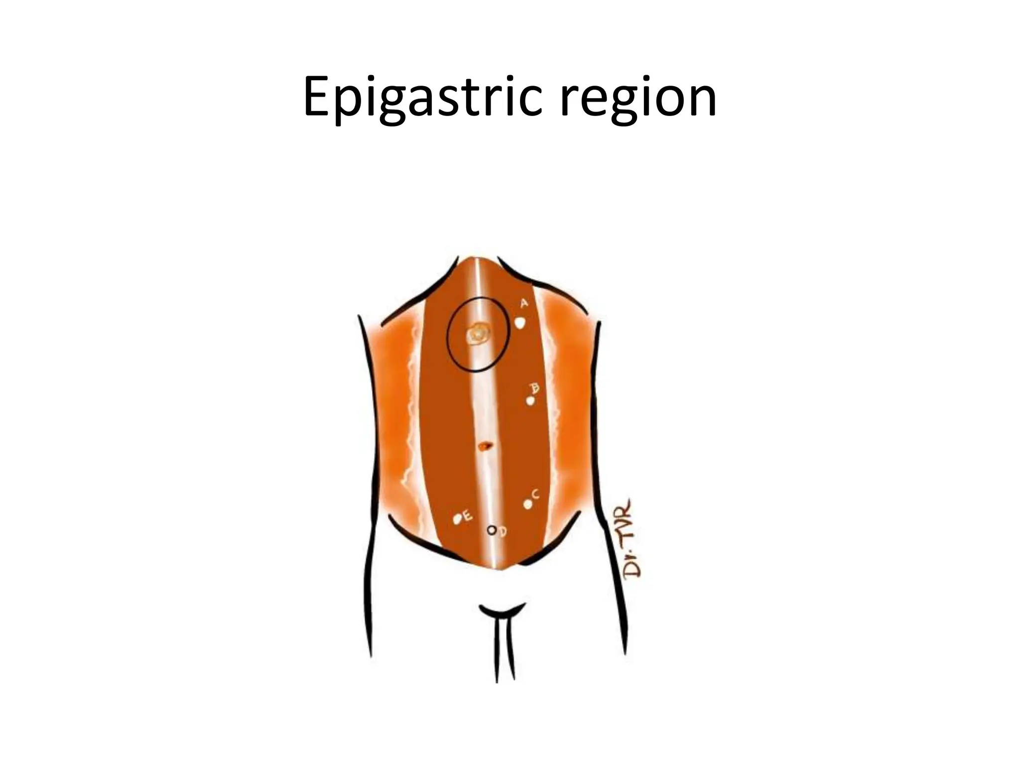 eTEP -RS Dr.TVR.pptx