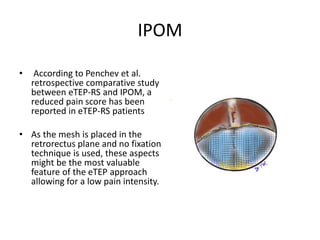 eTEP -RS Dr.TVR.pptx