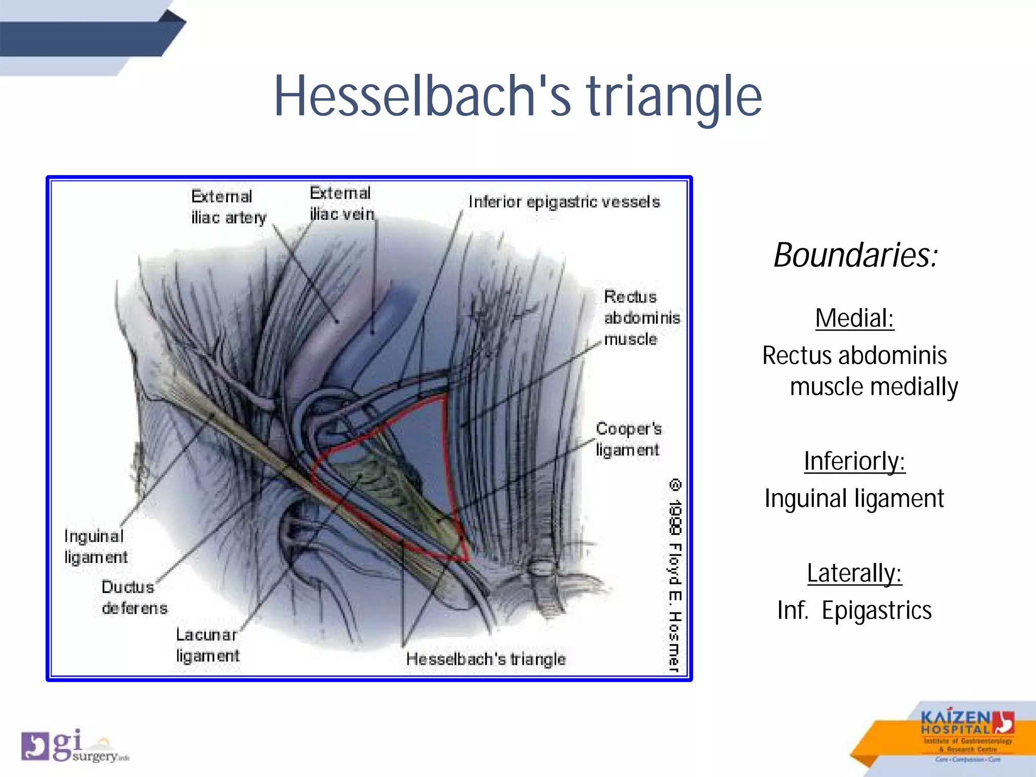 eTEP_for_Inguinal Hernias_Dr_Sanjiv_Haribhakti_www.gisurgery.info (1).pdf