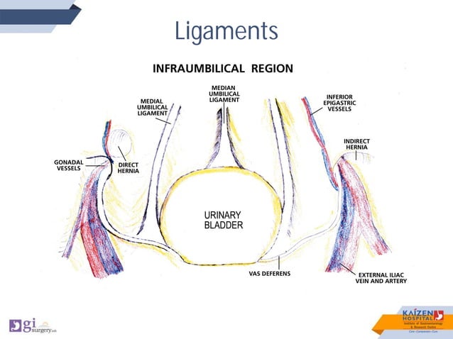 Etep For Inguinal Hernias Dr Sanjiv Haribhakti 1 Pdf