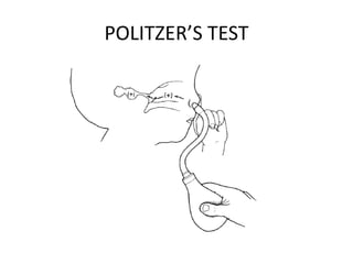 eustachian tube physiology ppt | PPTX