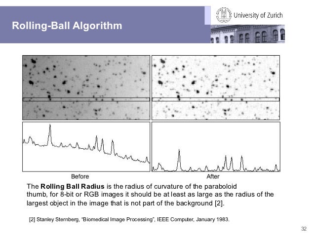 Artificial Intelligence in High Content Screening and Cervical Cancer…