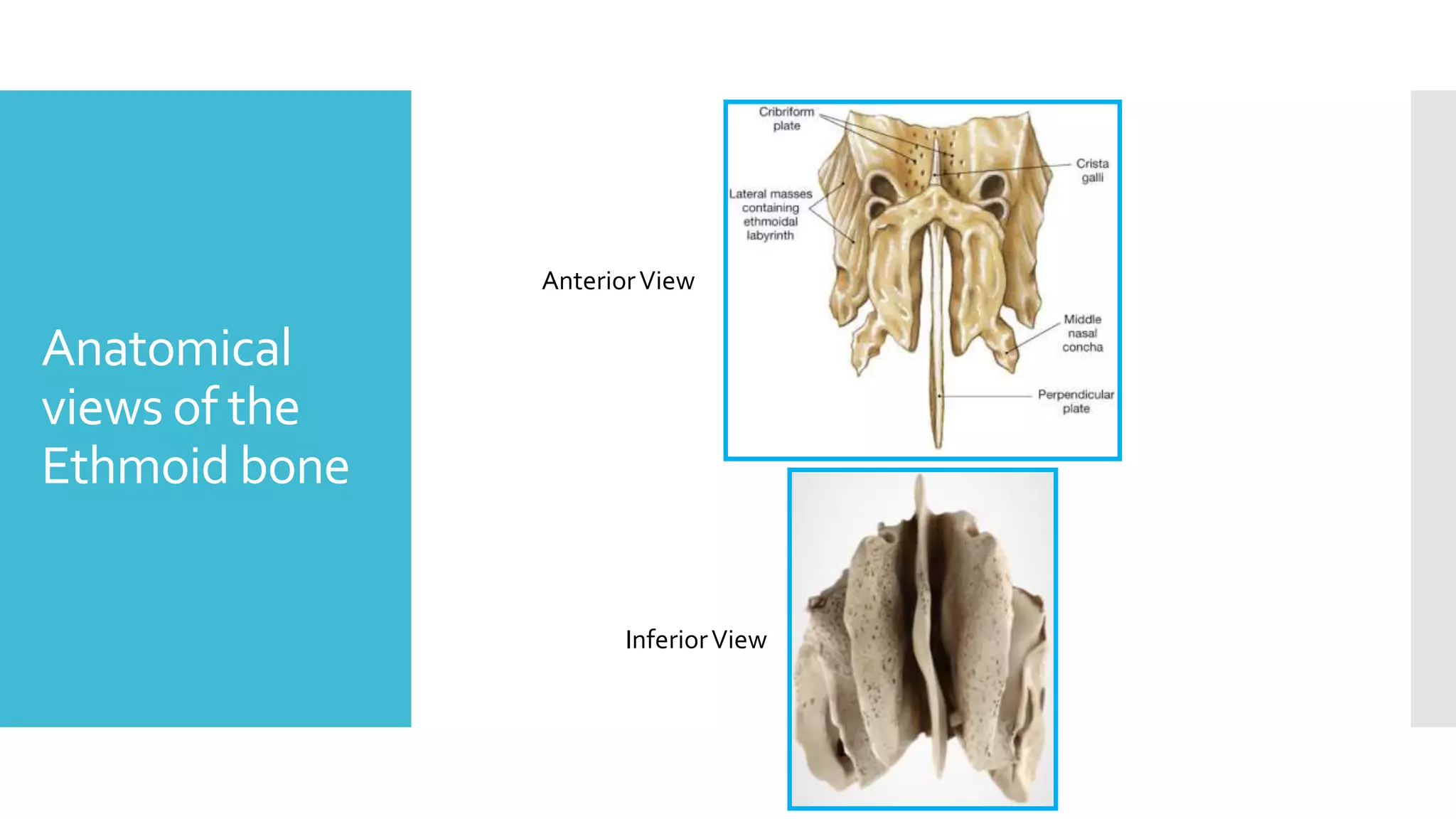 Skeletal System:- Neurocranium - Ethmoid bone | PPT