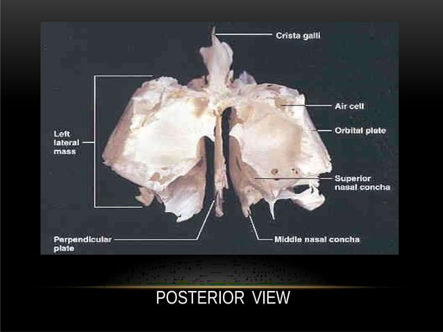 ANTOMICAL DETAILES OF ETHMOID BONE .pptx