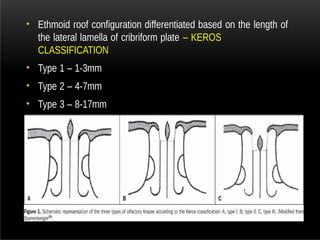 ANTOMICAL DETAILES OF ETHMOID BONE .pptx