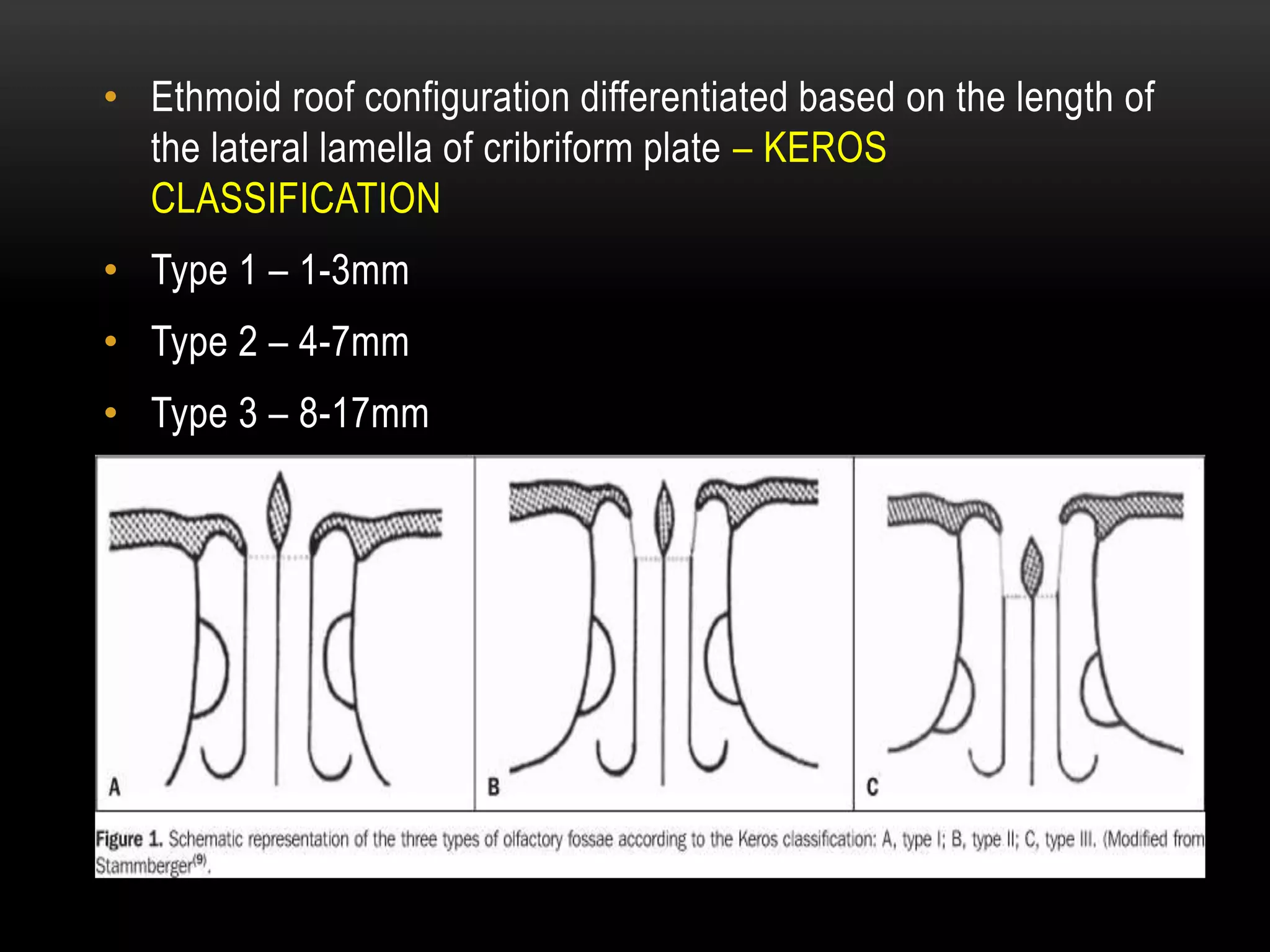 Ethmoid bone anatomy | PPTX