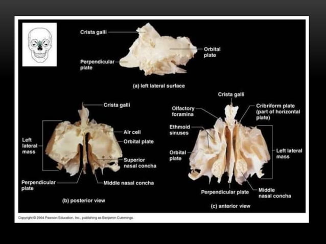 Ethmoid bone anatomy | PPTX | Ear, Nose and Throat Conditions ...