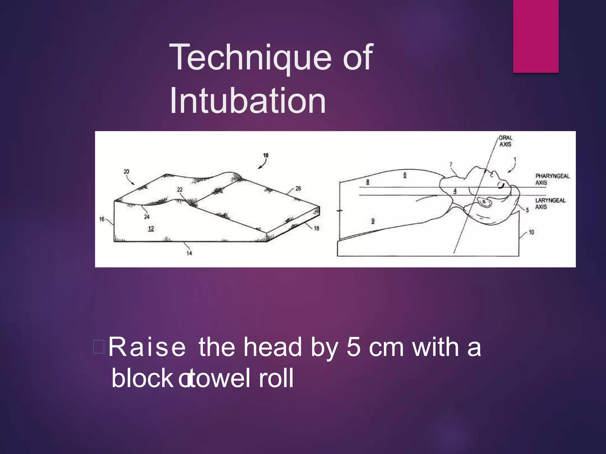 ET intubation( Endotracheal Intubation) | PPTX