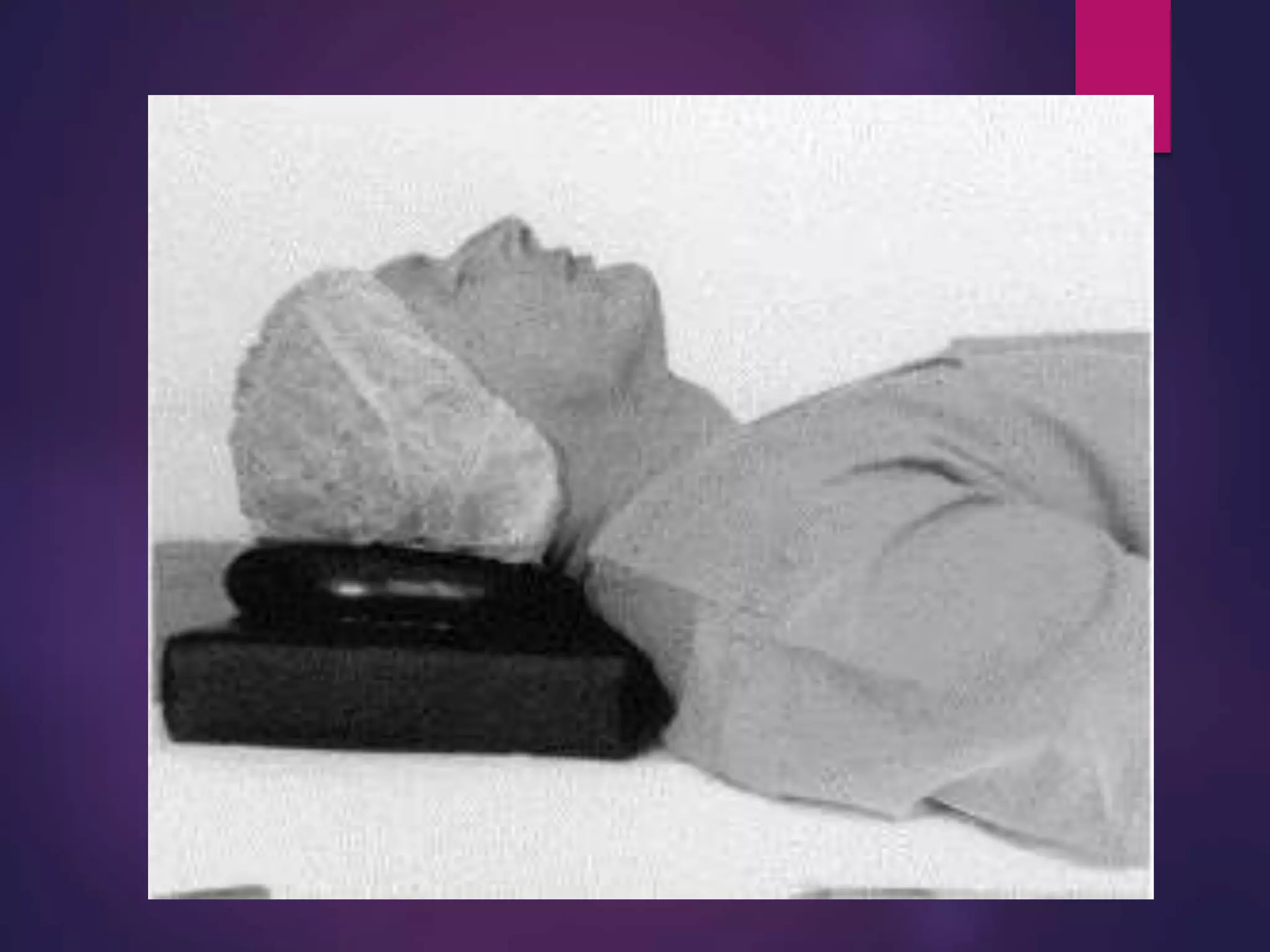 ET intubation( Endotracheal Intubation) | PPTX