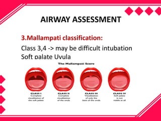 Endotracheal intubation | PPTX