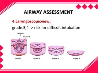 Endotracheal intubation | PPT