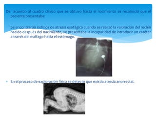 Etiologia de la asosiacion sindrome de vacterl | PPTX
