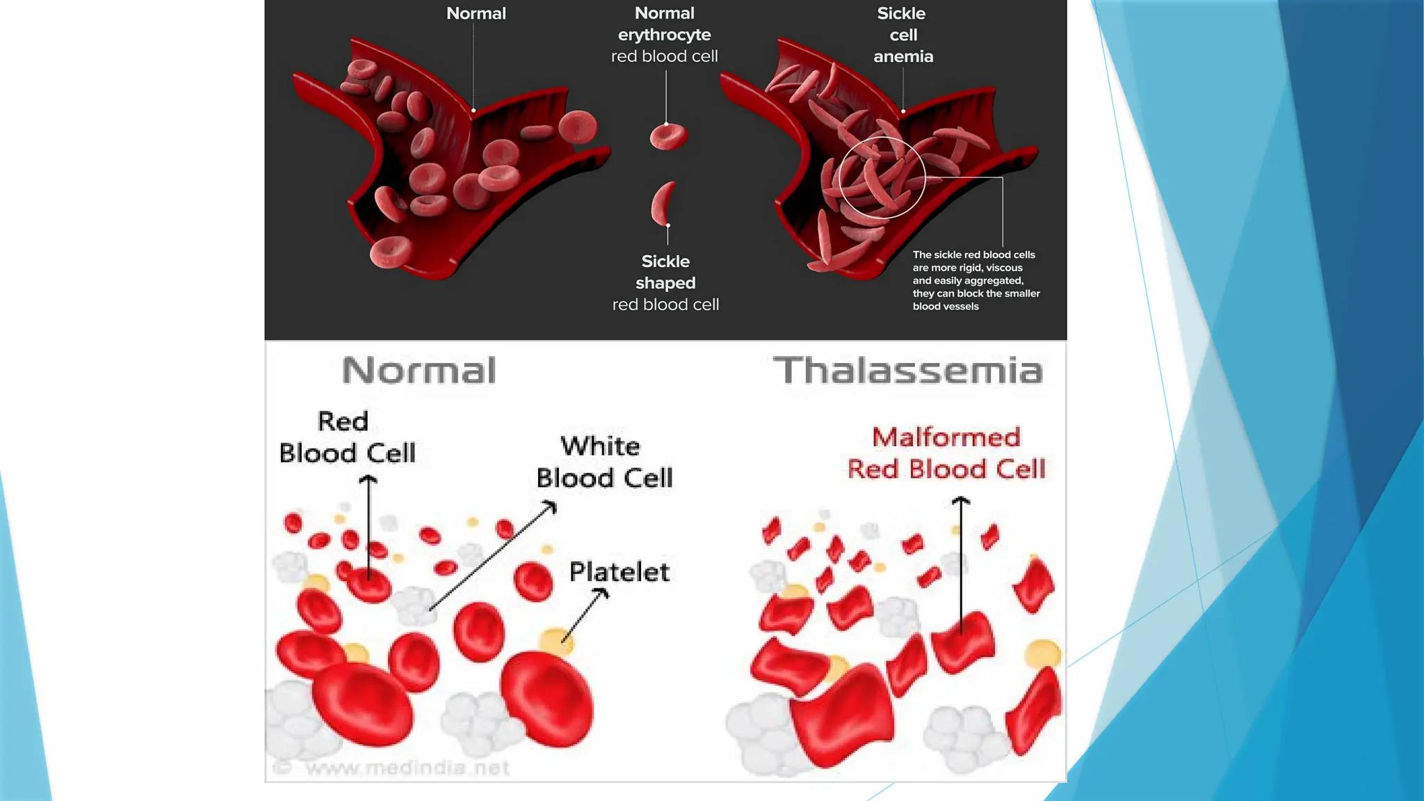 ETIOLOGICAL CLASSIFICATION OF ANEMIA.pptx