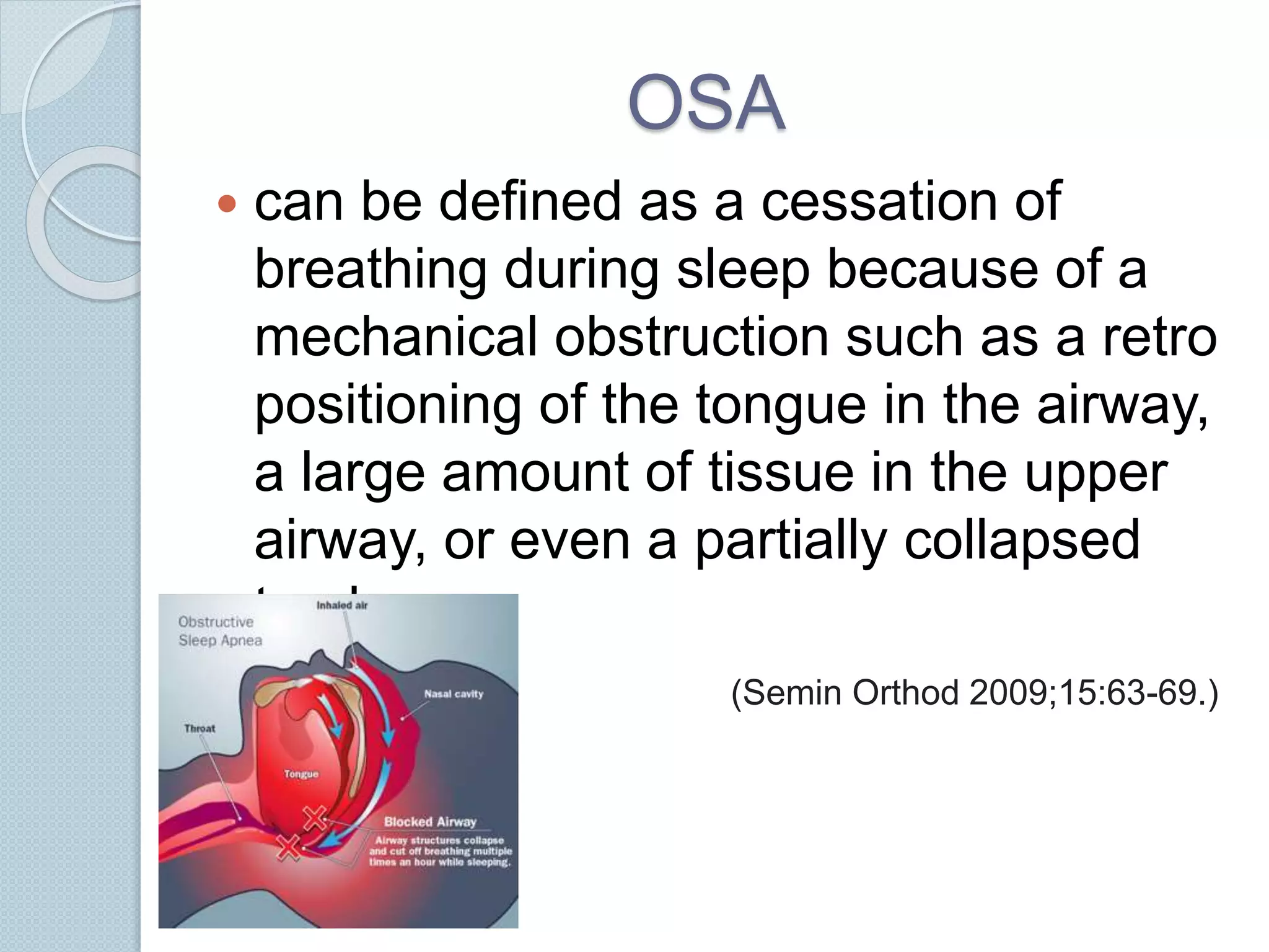 Etiology Of Obstructive sleep apnea | PPTX