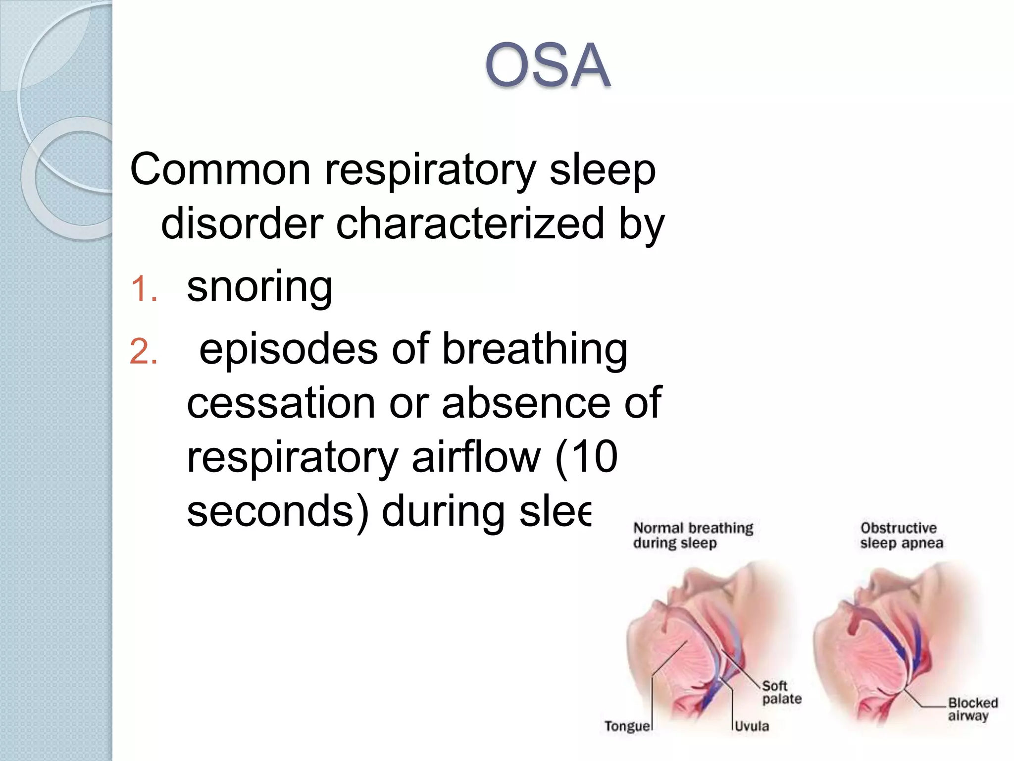 Etiology Of Obstructive sleep apnea | PPT