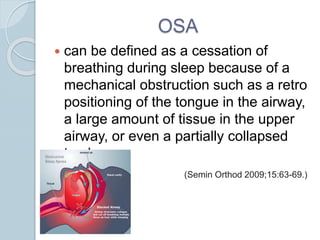 Etiology Of Obstructive sleep apnea | PPTX