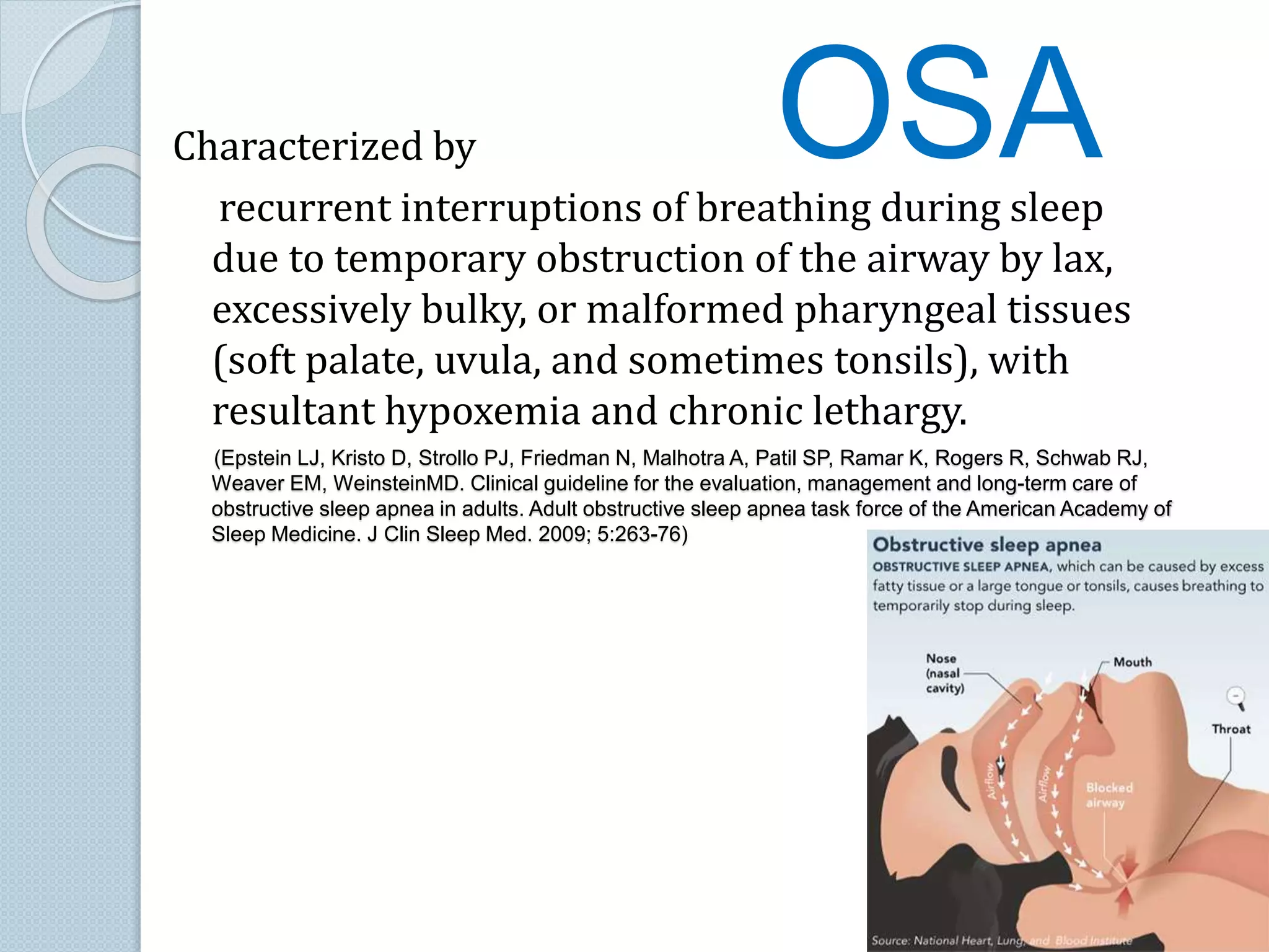 Etiology Of Obstructive sleep apnea | PPTX