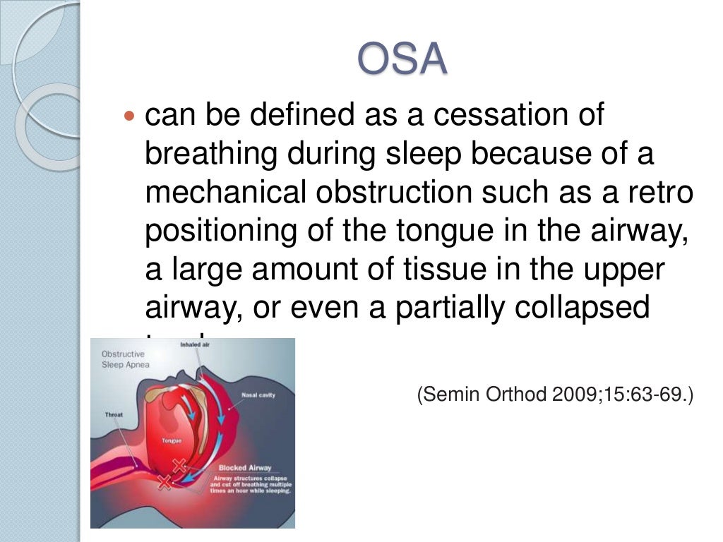 Etiology Of Obstructive Sleep Apnea