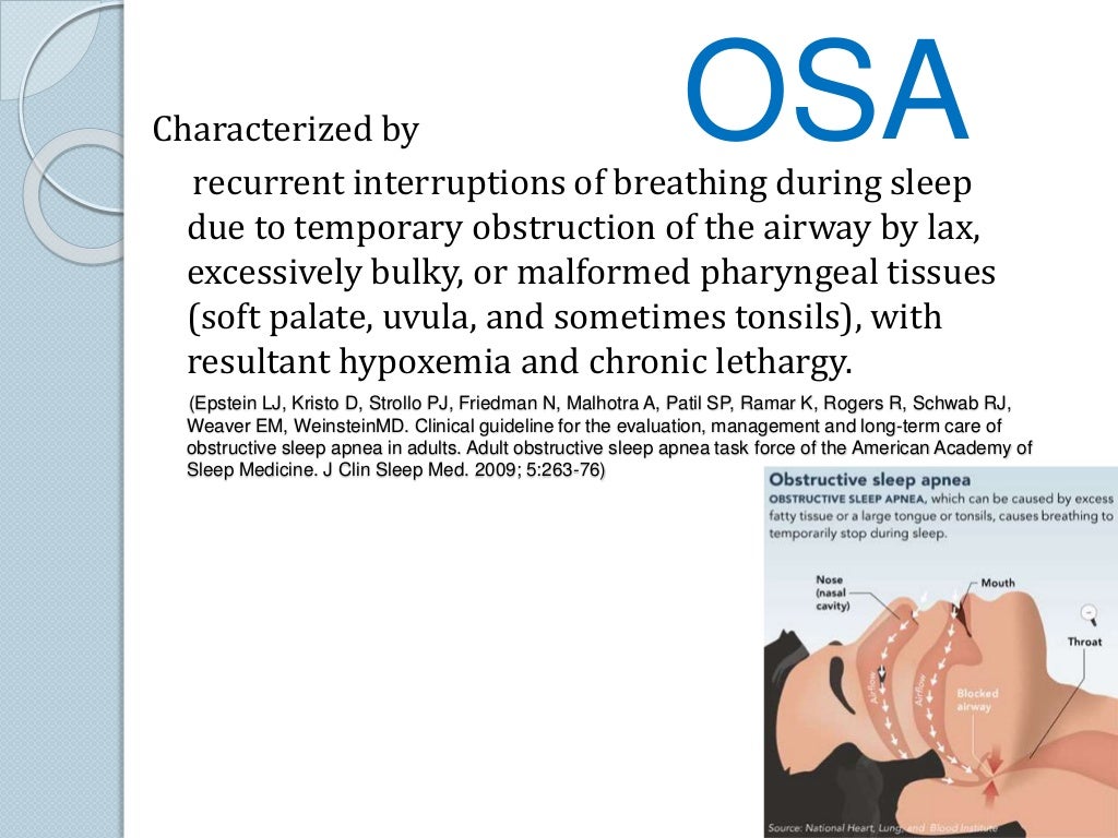 Etiology Of Obstructive Sleep Apnea