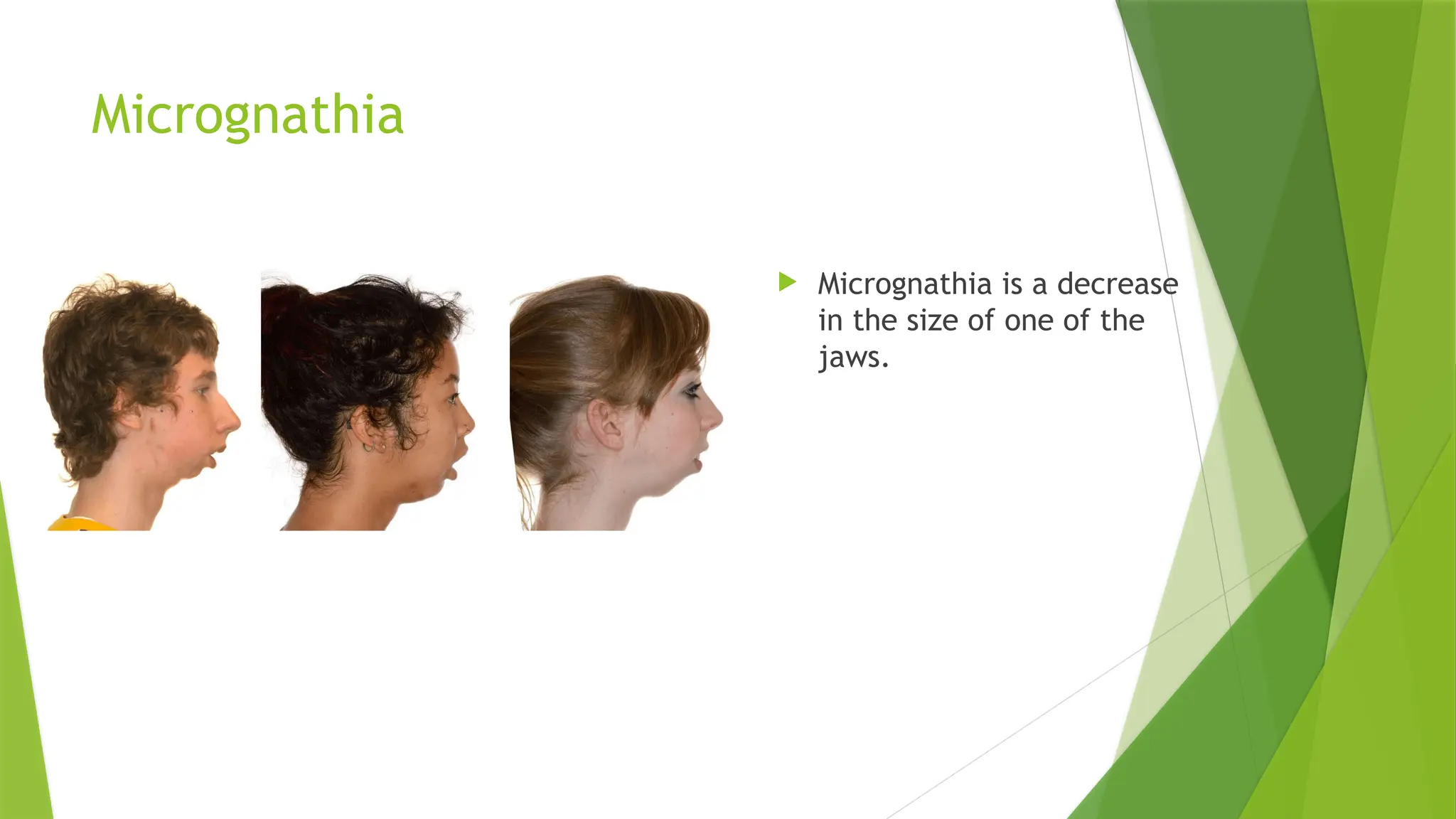 Etiology and pathogenesis of anomalies of the maxillofacial system.pptx