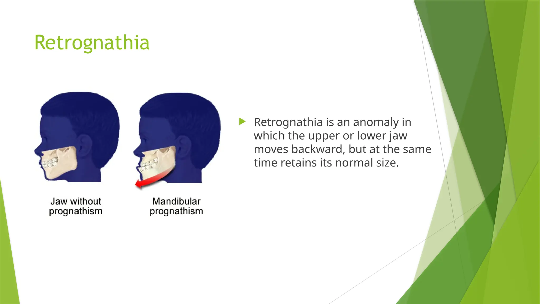Etiology and pathogenesis of anomalies of the maxillofacial system.pptx