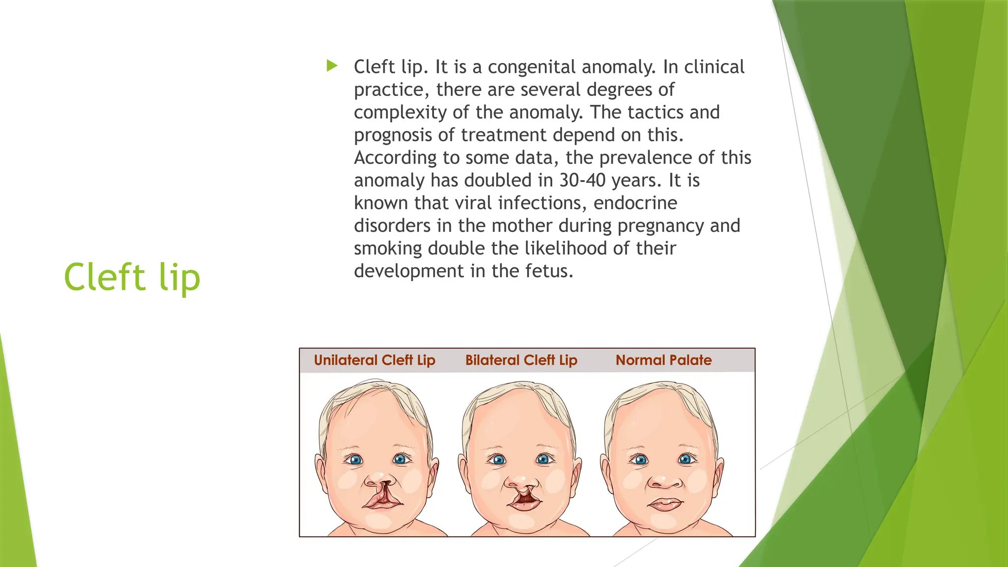 Etiology and pathogenesis of anomalies of the maxillofacial system.pptx