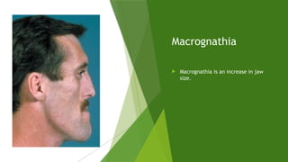 Etiology and pathogenesis of anomalies of the maxillofacial system.pptx