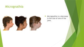 Etiology and pathogenesis of anomalies of the maxillofacial system.pptx