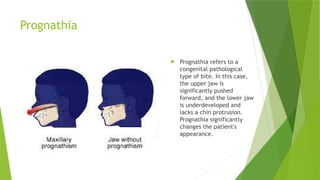 Etiology and pathogenesis of anomalies of the maxillofacial system.pptx