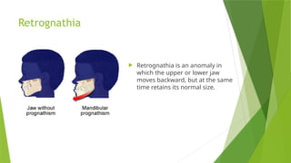 Etiology and pathogenesis of anomalies of the maxillofacial system.pptx