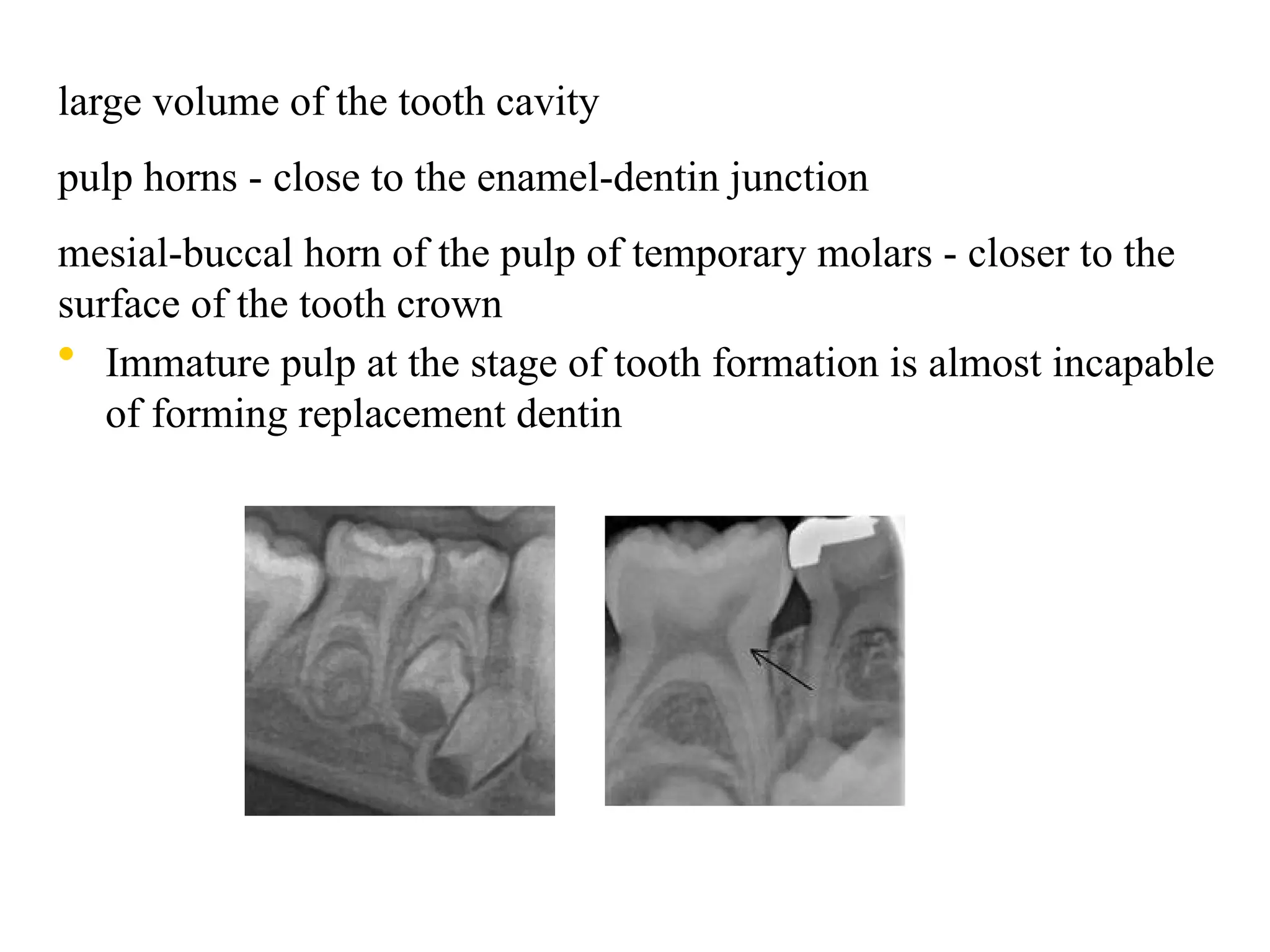 ETIOLOGY AND PATHOGENESIS OF DENTAL CARIES. CLASSIFICATION OF CARIES ...