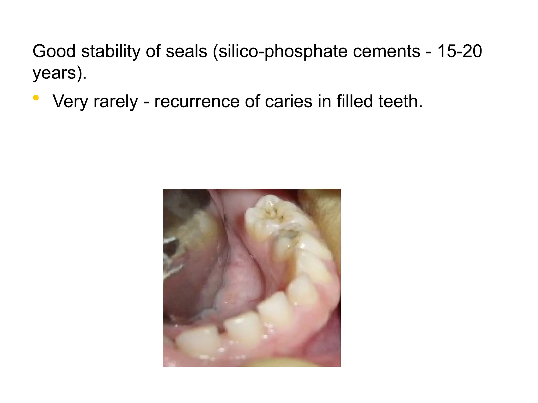 ETIOLOGY AND PATHOGENESIS OF DENTAL CARIES. CLASSIFICATION OF CARIES ...