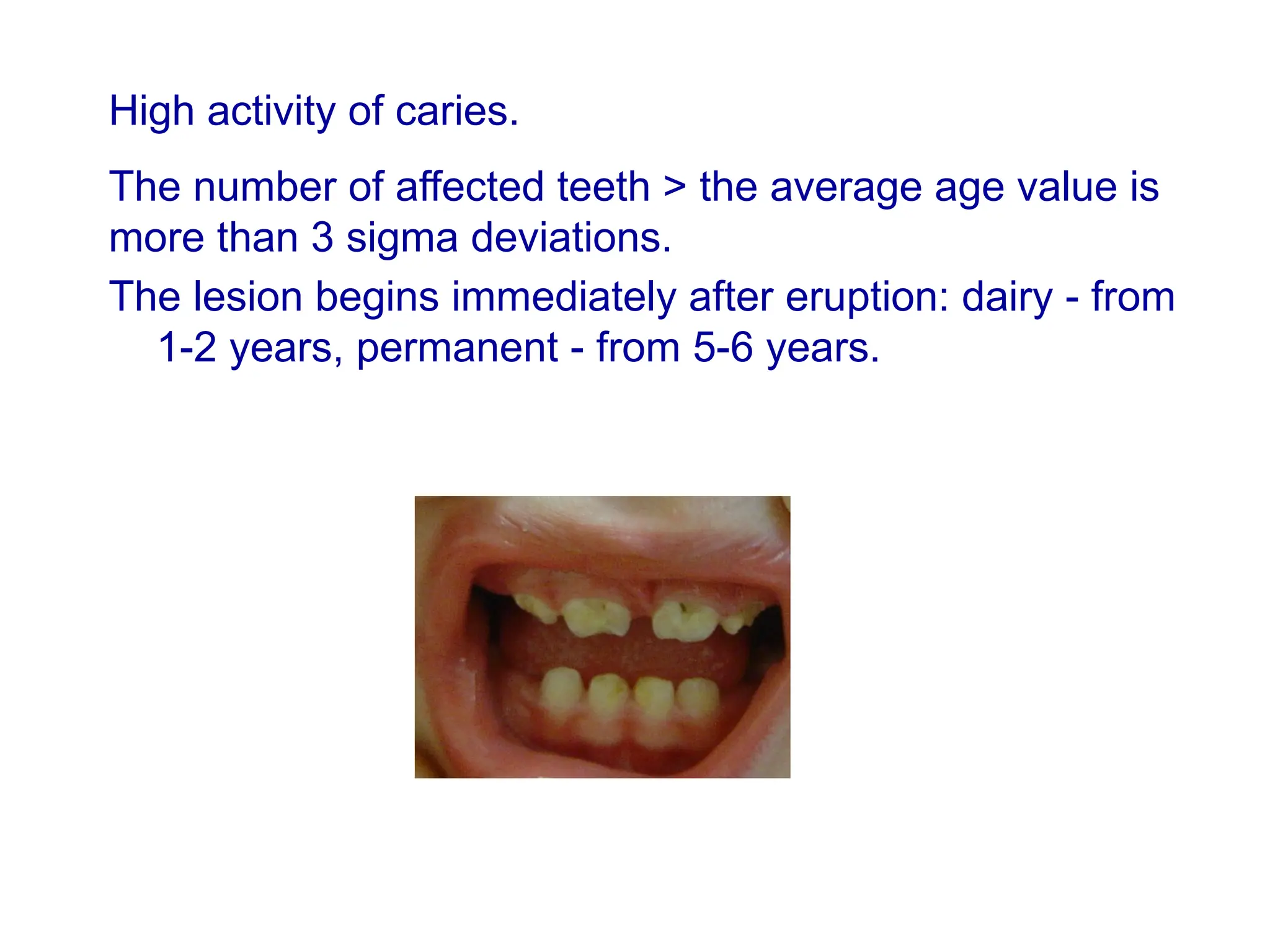 ETIOLOGY AND PATHOGENESIS OF DENTAL CARIES. CLASSIFICATION OF CARIES ...