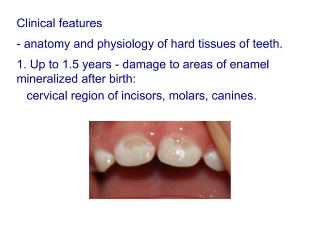 ETIOLOGY AND PATHOGENESIS OF DENTAL CARIES. CLASSIFICATION OF CARIES ...