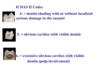 ETIOLOGY AND PATHOGENESIS OF DENTAL CARIES. CLASSIFICATION OF CARIES ...