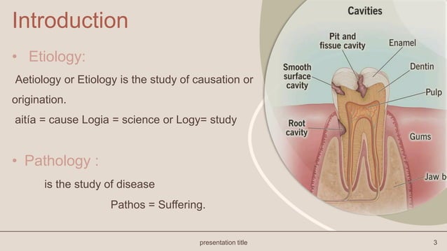 etiology and pathogenies of dental caries.pptx