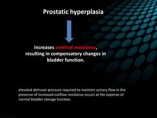 Benign Prostatic Hyperplasia Pathophysiology