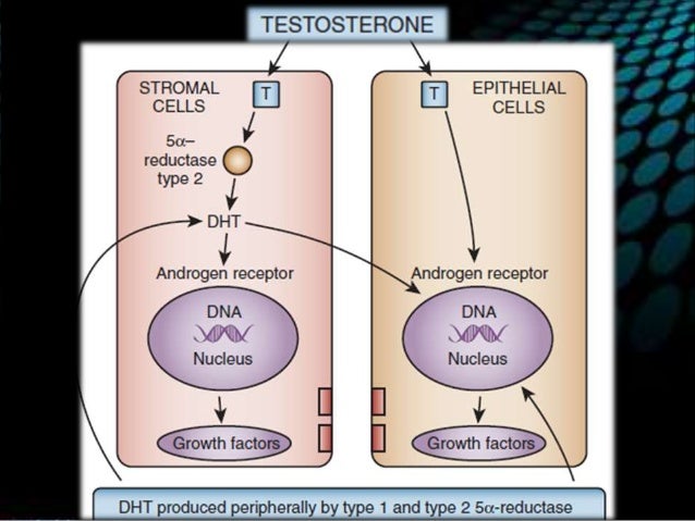 Benign Prostatic Hyperplasia Pathophysiology Diagram